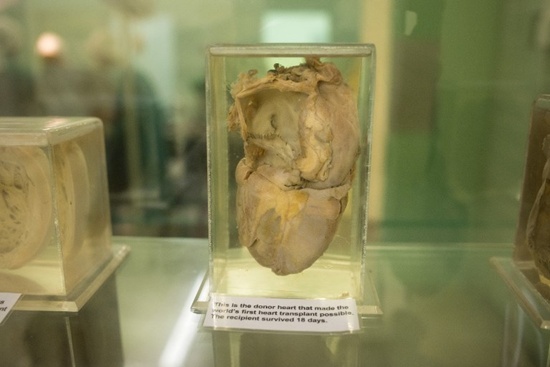 The world's first organ transplants