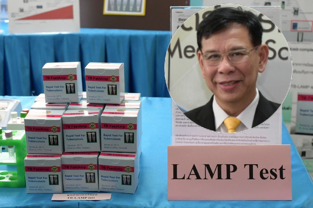 สธ.พัฒนานวัตกรรม "TB LAMP" ตรวจเชื้อวัณโรคไวขึ้น 1,000 เท่า จ่อใช้ ต.ค. ...