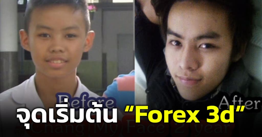 เผยจุดเริ่มต้นของ "Forex 3D" รีวิวศัลยกรรมของ "อภิรักษ์" อยากเป็นดารา ...